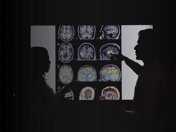 Cleveland Clinic Neurological Institute